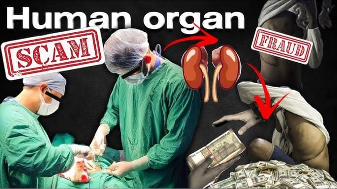Organs for Sale & How the British Public Became Commodities in a Cost ...